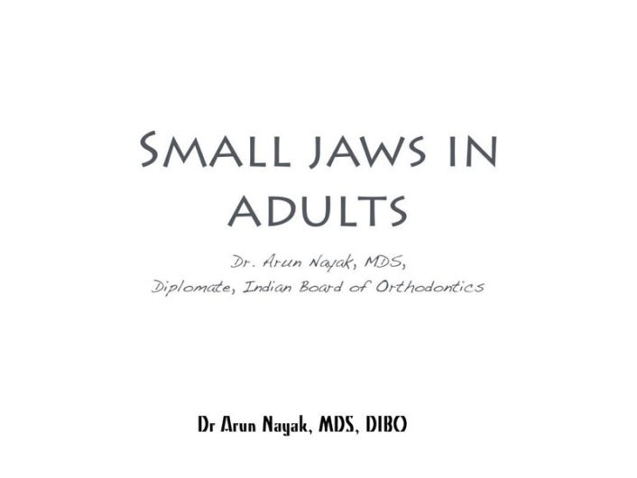 Small Jaws in Adults - Fort Dental Clinic