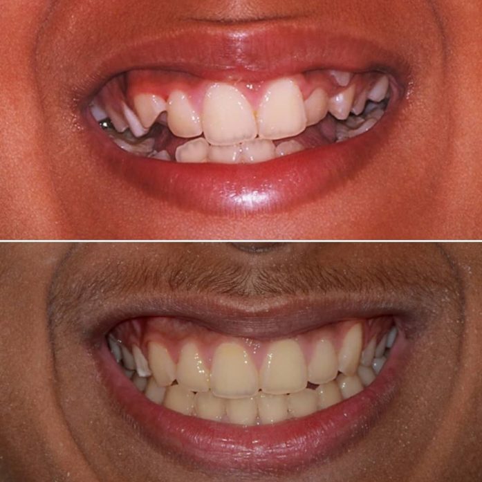 Importance of Dental Health at Fort Dental Clinic Mumbai